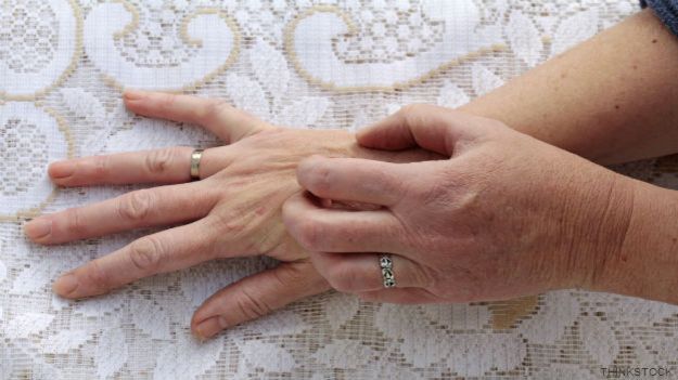 ¿Por qué alivia rascarse?