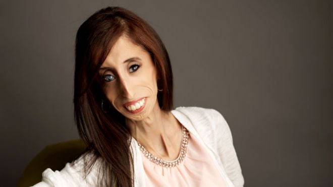 La inspiradora historia de Lizzie Velásquez y cómo le cambió que la ...