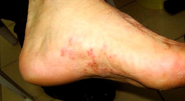 Hongoenlaplantadelpie