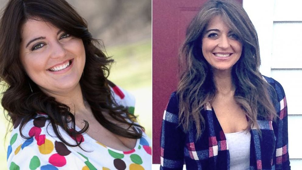 Tras perder 59 kilos, esta mujer hoy muestra sus estrías con orgullo en ...