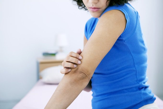 Blanquea e hidrata tus codos con estos buenísimos consejos