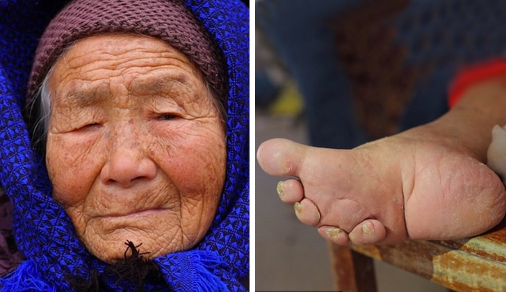 Las modificaciones corporales más extremas del mundo.