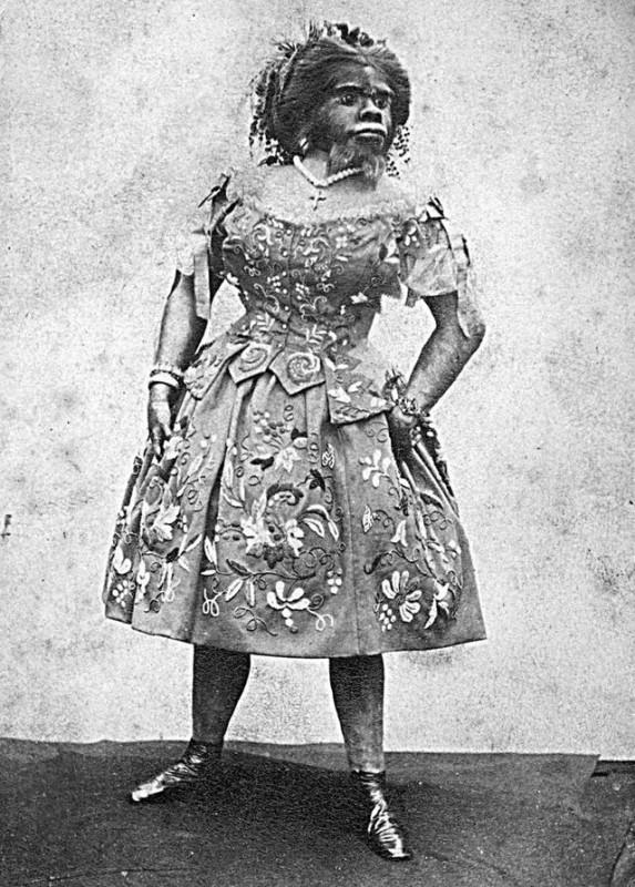 (Fotos)Conoce la triste historia de la "mujer simio" que tuvo un final ...