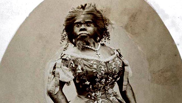 (Fotos)Conoce la triste historia de la "mujer simio" que tuvo un final ...