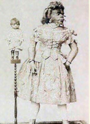 (Fotos)Conoce la triste historia de la "mujer simio" que tuvo un final ...