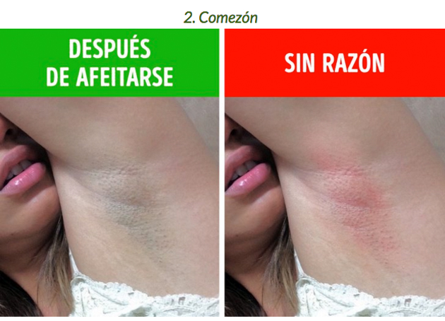 Las axilas pueden dar señales de que padeces una enfermedad