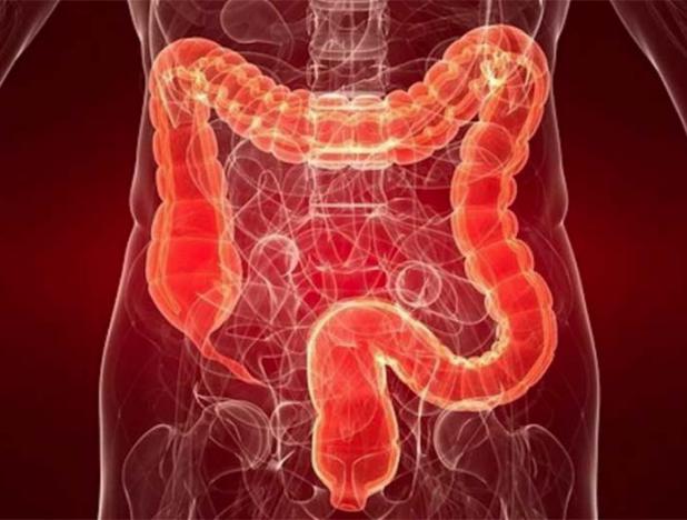 Nueva técnica de transplantes fecales se ha convertido en una solución ...