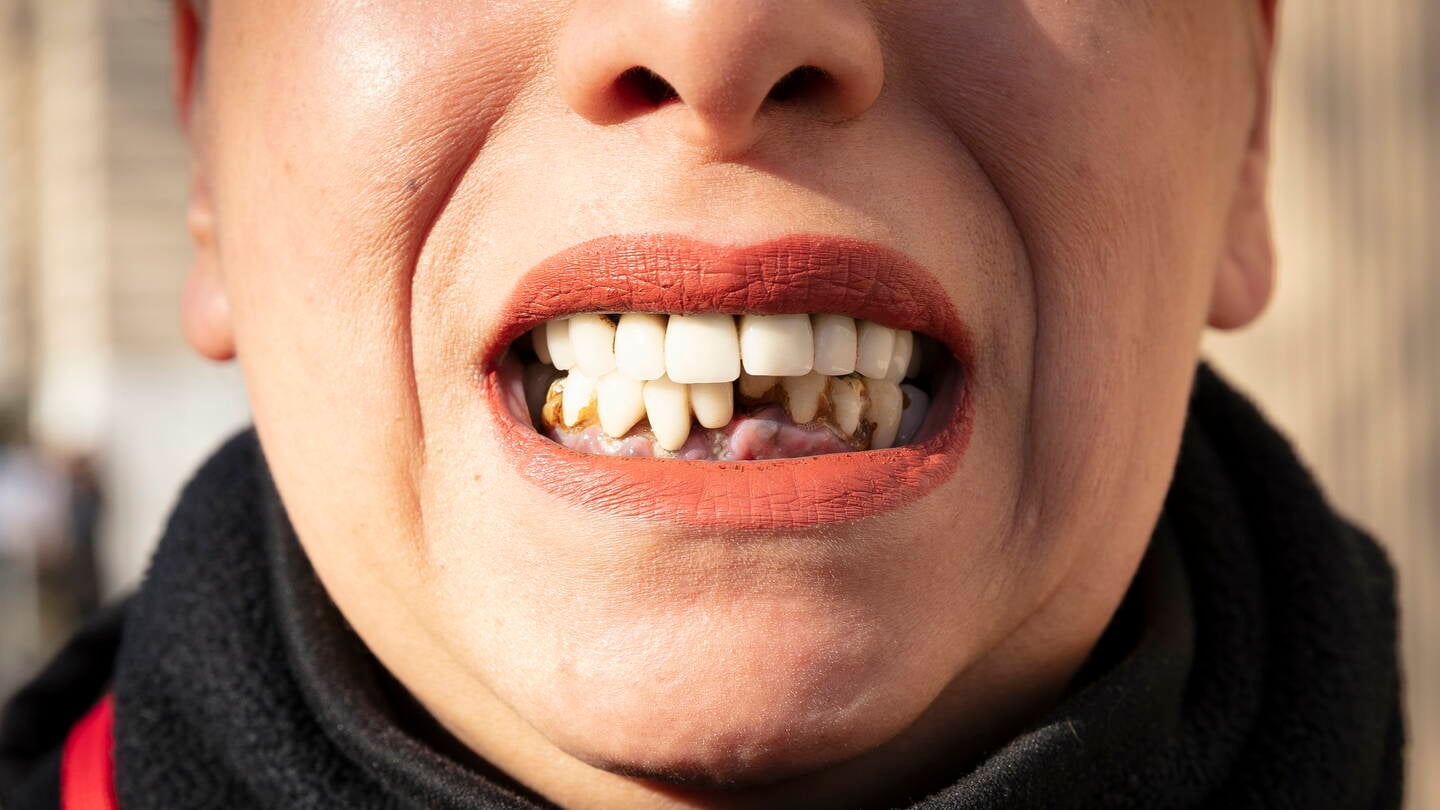 Condenado dentista multimillonario por mutilar deliberadamente a ...